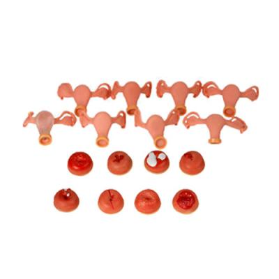 China Uterus simulator voor gynaecologisch anatomie model gebruikt in verpleegkunde-verloskunde en moederschap Te koop