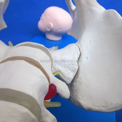 China Levendig bekken en foetale hoofden Geavanceerd PVC-model voor geboortevaardigheden demonstratie Te koop