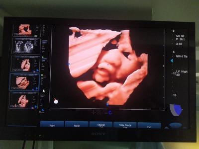 China Standard  Ultrasound Scanner Machine 21.5 Inch  High Definition Medical Te koop
