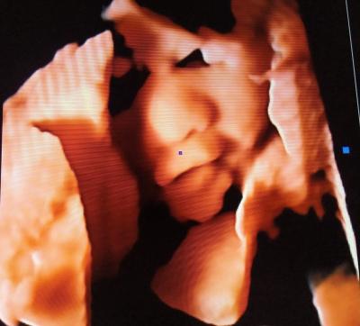 China Standard  Ultrasound Scanner Machine 21.5 Inch  High Definition Medical Te koop