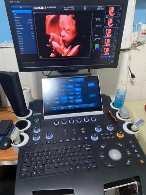 China Standard  Ultrasound Scanner Machine 21.5 Inch  High Definition Medical Te koop
