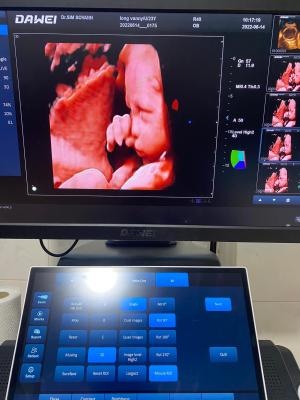 China Standard  Ultrasound Scanner Machine 21.5 Inch  High Definition Medical Te koop