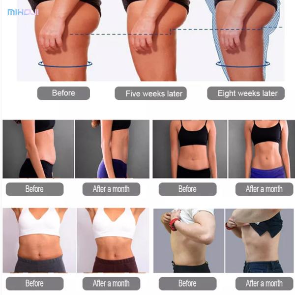 Quality Electrical Muscle Sculpting Machine Emslim Neo RF Operation With 2 Handles for sale