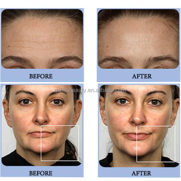 Quality UK Plugs Face Muscle Stimulator Machine STANDING For Skin Tightening for sale