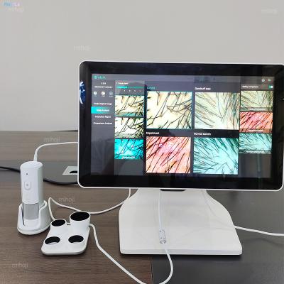 China EU Plugs Type 4 In 1 Scalp Care Machine Multi Language For Hair Oiliness Analysis for sale