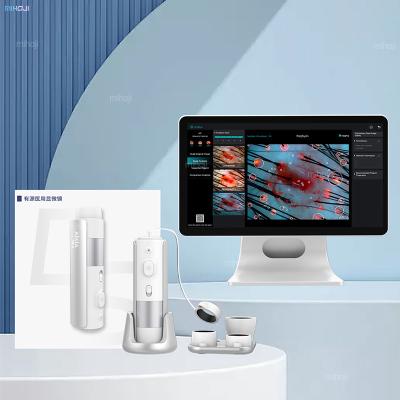 China EU Plugs Type 4 In 1 Scalp Care Machine Multi Language For Hair Oiliness Analysis for sale