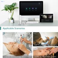 China Customizable Scalp Analysis Machine For Dryness And Dandruff Problem for sale