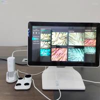 China Customizable Scalp Analysis Machine For Dryness And Dandruff Problem for sale