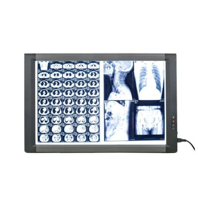 China 21 Inch Medical Film Viewer 30W MRI Film Viewer Effortlessly View And Analyze DICOM Images for sale