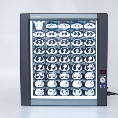 China Desktop LED X Ray Viewer 1920X1080 Medical X Ray Viewer For Viewing And Analyzing Medical Images for sale