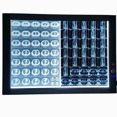 China User Friendly X Ray Viewers SRGB X Ray Light Box 30W With DICOM Compatibility for sale