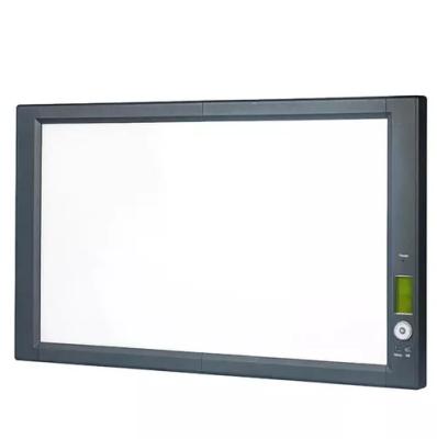 China HDMI Input Ports Medical Film Viewer Desktop X Ray Film Viewer 21 Inch 1000 1 Contrast Ratio for sale