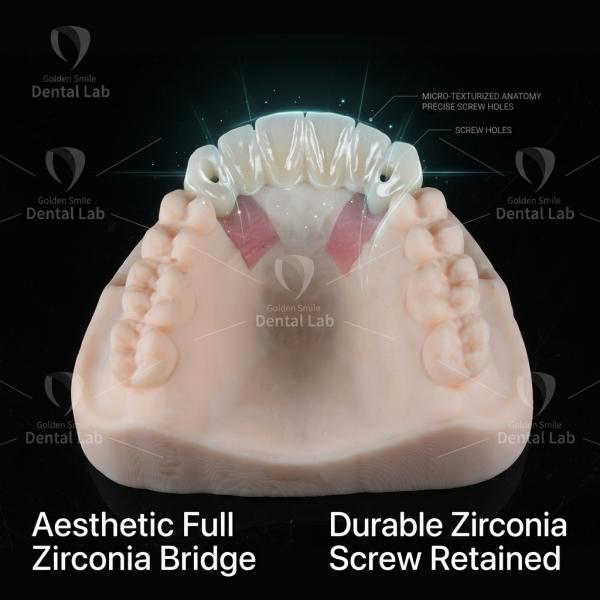 Quality CAD CAM Digital Dental Lab Screw Retained Bridge Customizable for sale