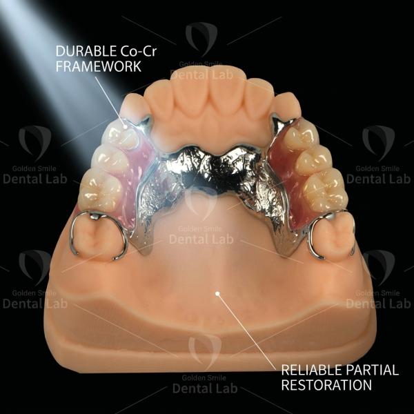 Quality Acrylic Printed Partial Framework Design China Dental Lab Comfort for sale