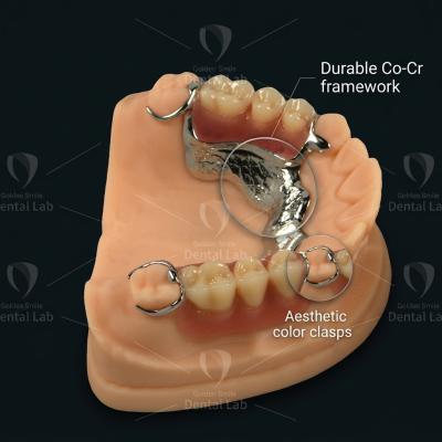 China CE Modern Dental Lab China 3D Printed Partial Denture Medical Grade for sale