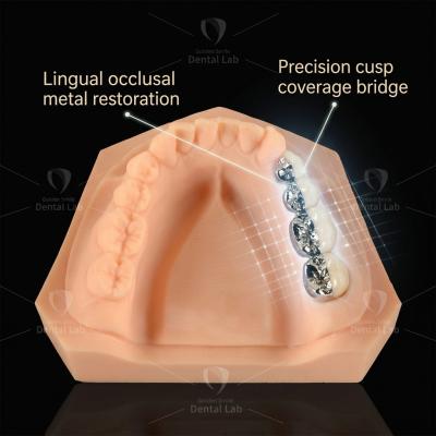 China Dental Laboratory China High Precision PFM Bridge CDT / MDT Quality Control for sale