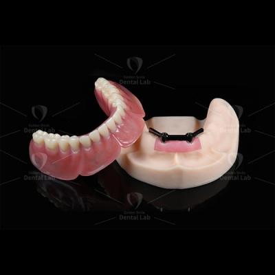 China Dental Implant Bar Titanium CAD CAM With Teeth Shape Screw Included for sale