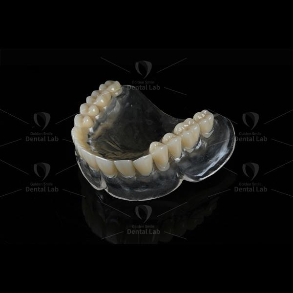 Quality Vertex Clear Flexible Denture Transparent Removable Partial Denture for sale