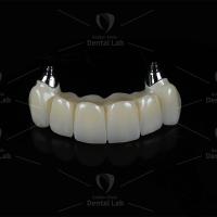 China Multilayered Full Zirconia Bridge Screw Retained Bridge Customizable for sale