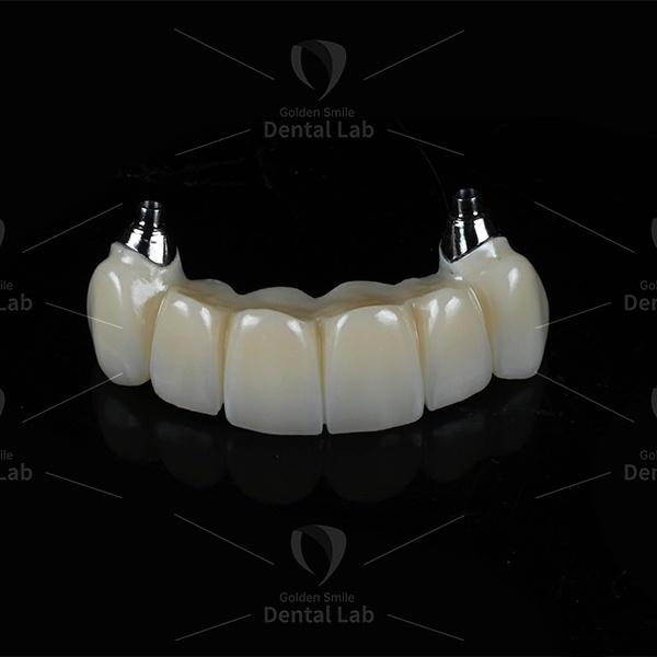 Quality Multilayered Full Zirconia Bridge Screw Retained Bridge Customizable for sale