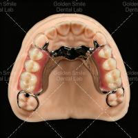 Quality Custom Co-Cr Metal Framework Partial Denture , Acrylic Base With Metal, Acetal for sale