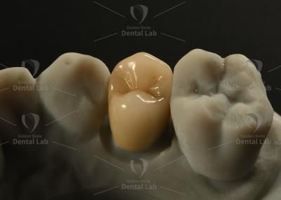 China High-strength Biocompatible Stain-resistant Full Zirconia Dental Crown for All Ceramic Restorations for sale
