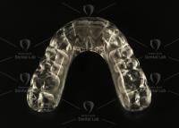 Quality Custom 3D Printed Hard Occlusal Splint Dental Bite Guard for Bruxism Treatment for sale
