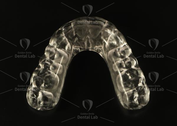 Quality Custom 3D Printed Hard Occlusal Splint Dental Bite Guard for Bruxism Treatment with Medical-grade Resin and High-precision Fit for sale