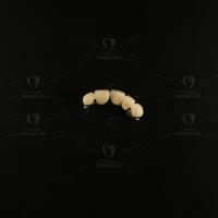 China Precision Ball Attachment Removable Partial Denture China Dental Lab for sale