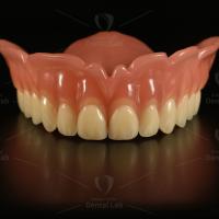 China Complete Edentulous Denture | Full Arch Removable Denture for sale