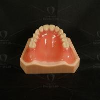 China Complete Edentulous Denture | Full Arch Removable Denture for sale