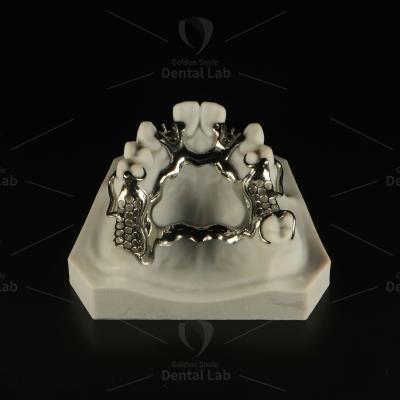 China Custom Ultra-Thin Biocompatible Dental Metal Framework for Removable Partial Denture and Metal Partial Denture Restoration for sale