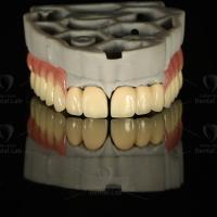 China Bridge with Ball Cap Attachments & Metal Framework for sale