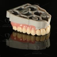 China Bridge with Ball Cap Attachments & Metal Framework for sale