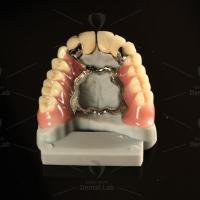 China Bridge with Ball Cap Attachments & Metal Framework for sale