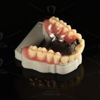 China Bridge with Ball Cap Attachments & Metal Framework for sale