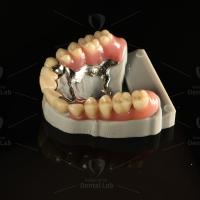 China Bridge with Ball Cap Attachments & Metal Framework for sale