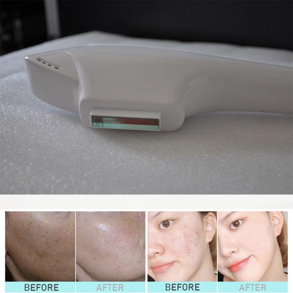 Quality qmmadical 2 in 1 IPL + diode laser Hair Removal beauty machine for sale