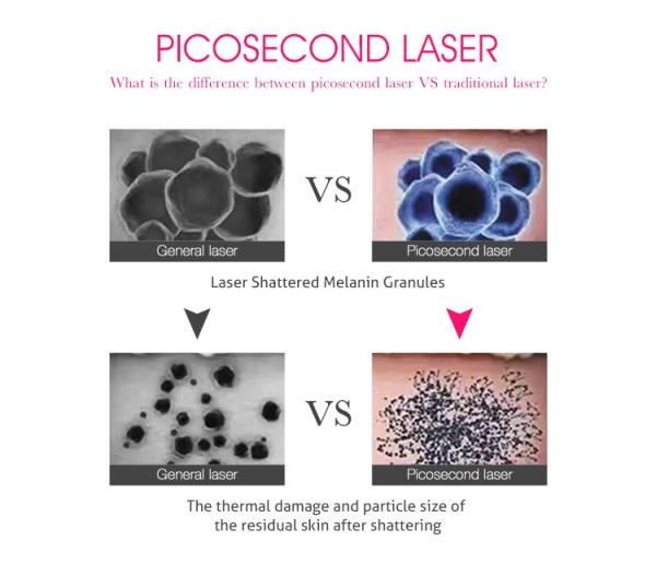 Quality FDA approved Picosure Laser 755nm Professional Tattoo Removal Machine for sale