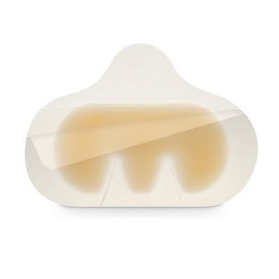 Self Adhesive hydrocolloid wound dressing for Foot Healing
