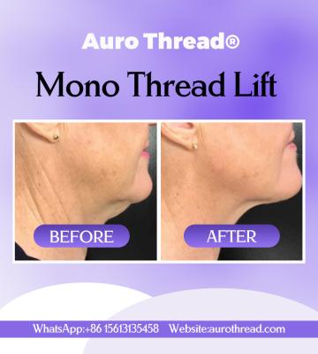 Cina Facial Beauty Lift Mono 29G 60mm Tensores Fio V Line Facial Lift Pdo Thread in vendita