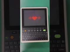 Elettrocardiografo Avanzato a 12 Derivazioni con Schermo Touchscreen da 10.4