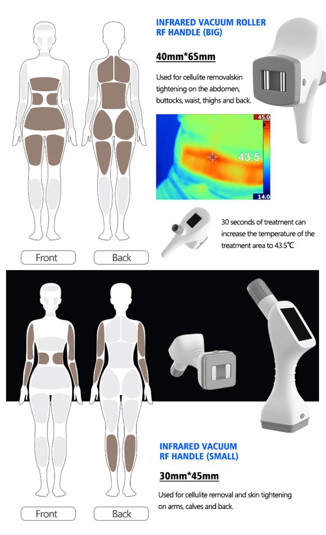 GOMECY VelaBody Rf Skin Tightening Vacuum Weight Loss Machine