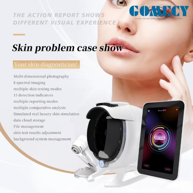 15 Types Detection Indicators Skin Analyzer Facial Diagnostic Skin Moisture Test Facial Analysis 3d Skin Analysis Machine
