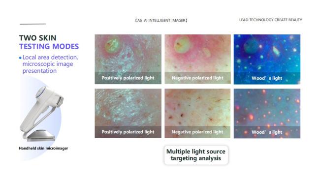 15 Types Detection Indicators Skin Analyzer Facial Diagnostic Skin Moisture Test Facial Analysis 3d Skin Analysis Machine