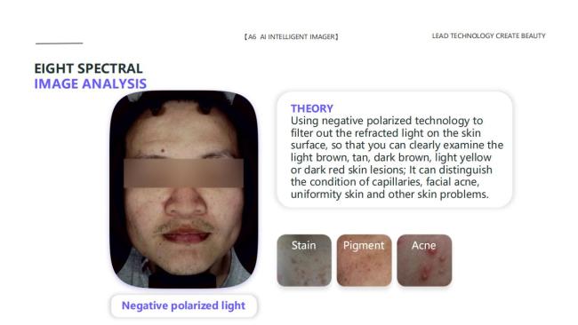 face-detection-skin-condition-analysis
