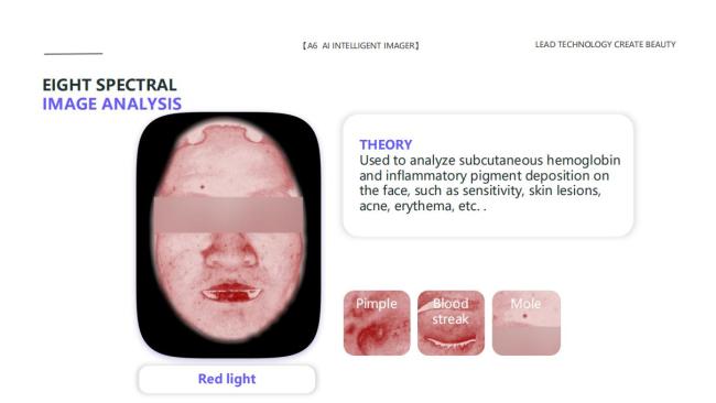 face-detection-skin-report-skin-analysis