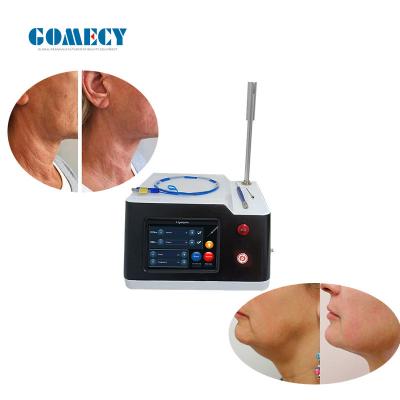 Cina 980nm 1470nm Endolift Laser Machine con raffreddamento ad aria 400μM 600μM 800μM Fibre Core Diameter in vendita