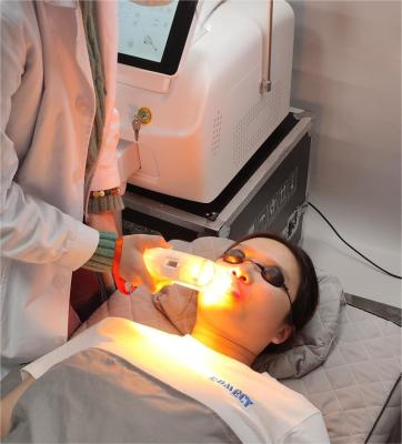 China IPL Portable Skin Hair Reduction Machine For Vascular Lesions And Facial Blemish Removal for sale