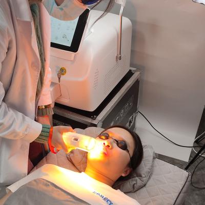 China Professional IPL Skin Hair Reduction Elight Machine for Acne And Pigment Removal for sale